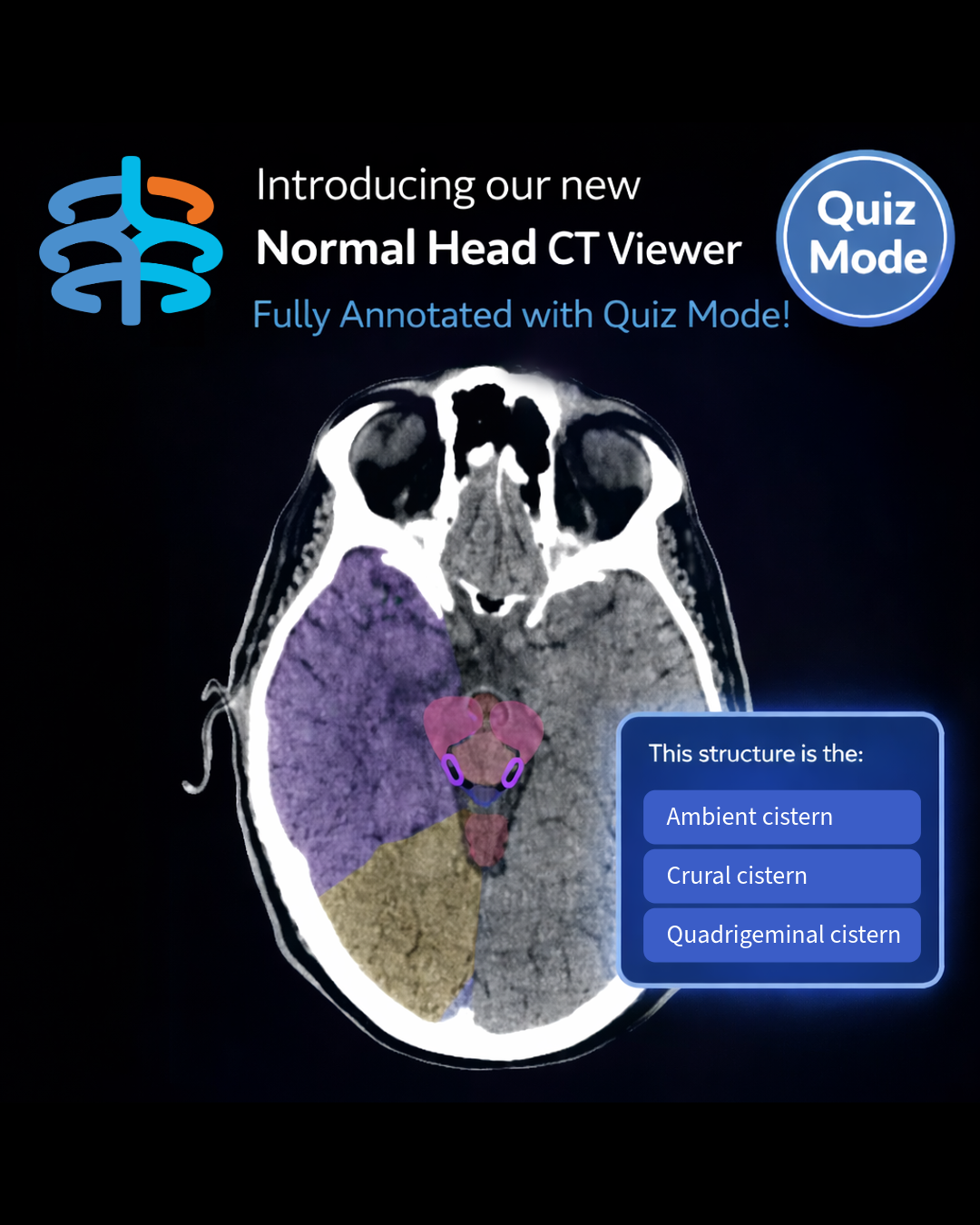 Normal CT Head Anatomy | Interactive Head CT Atlas | RadClerk